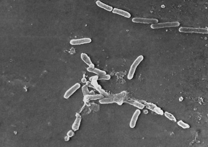 Eye drops recalled after drug-resistant bacteria outbreak linked to at ...