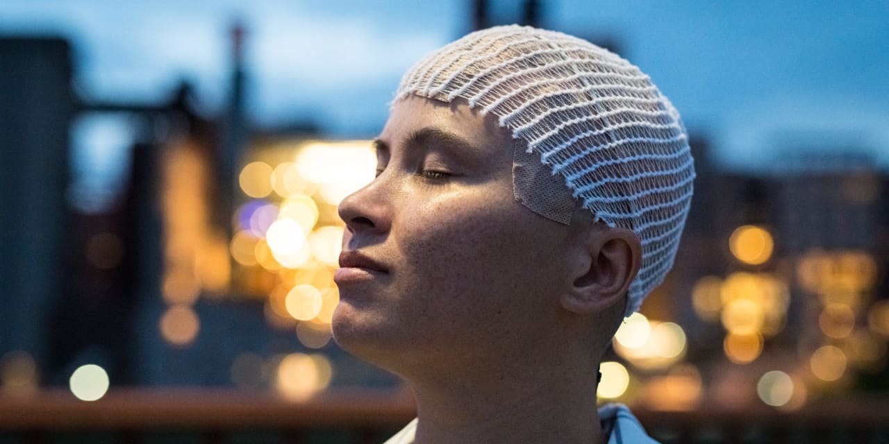 Novocure’s stock surges after positive results in brain-cancer trial ...