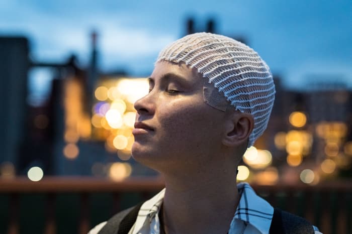 Novocure’s stock surges after positive results in brain-cancer trial ...